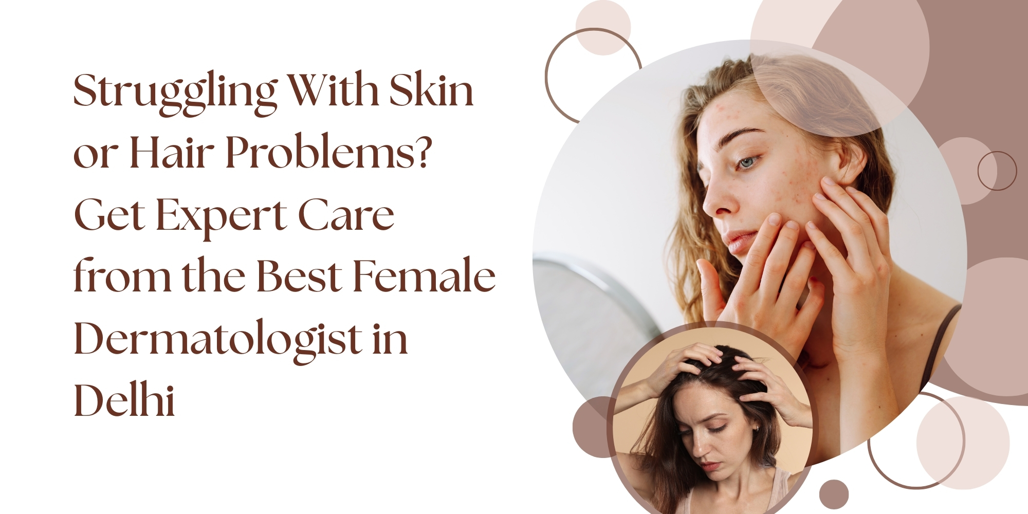 Skin & Hair Problems? Consult the Best Female Dermatologist Delhi